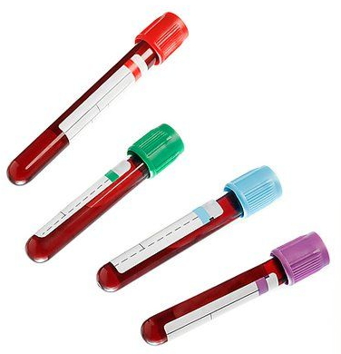 Blood_samples - Critical Care Practitioner