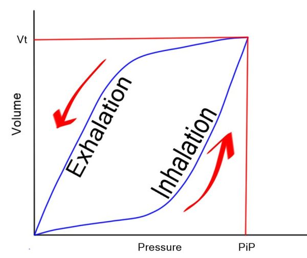 Mechanical Ventilation Series- Pressure/Volume loop….. - Critical Care ...