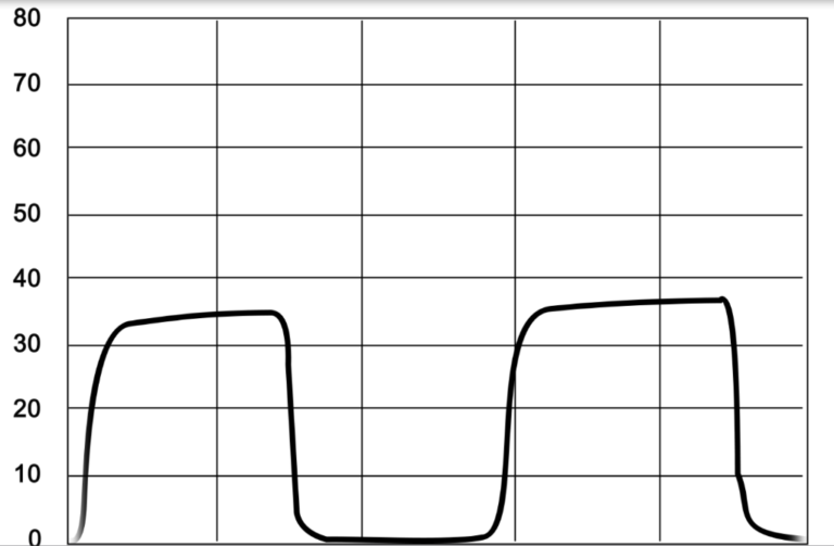 Capnography - Critical Care Practitioner