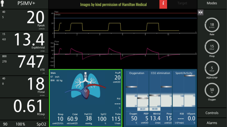 The Ventilator Screen- those numbers! - Critical Care Practitioner